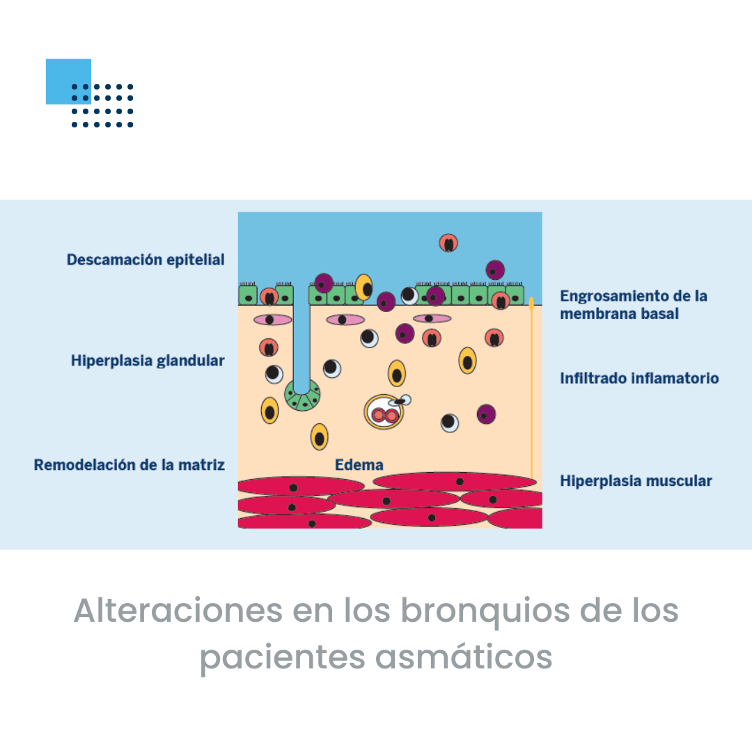 Conoce qué es el asma y su relación con las alergias - Dr. Daniel Amaya ...